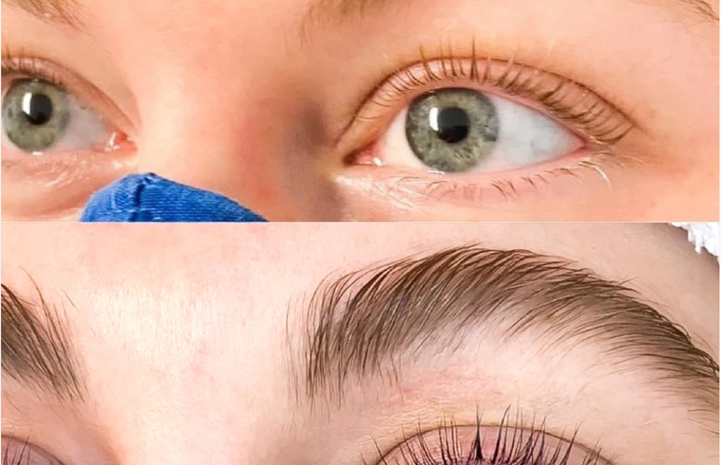 Why Are My Lashes Falling Out? Causes and Solutions – Revive7